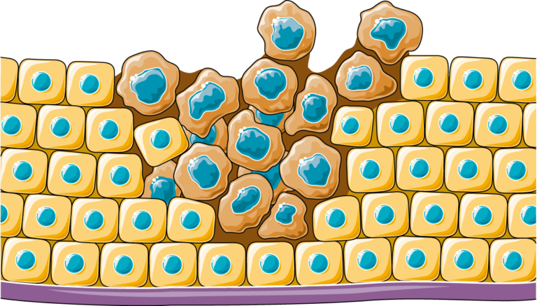 Cancerous cell - Servier Medical Art