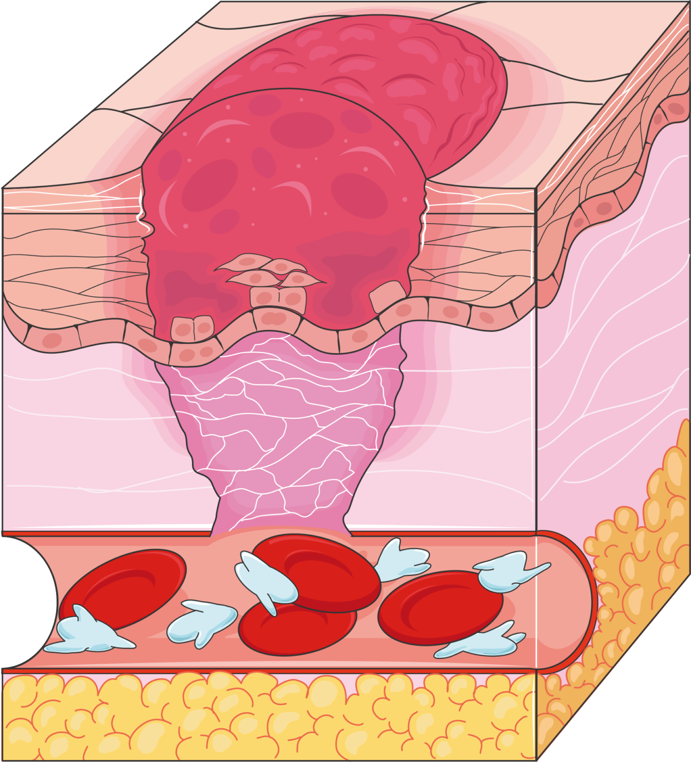 Blood - Page 5 of 10 - Servier Medical Art