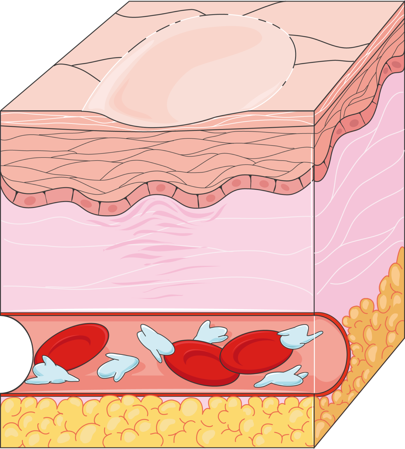 Blood - Page 5 of 10 - Servier Medical Art