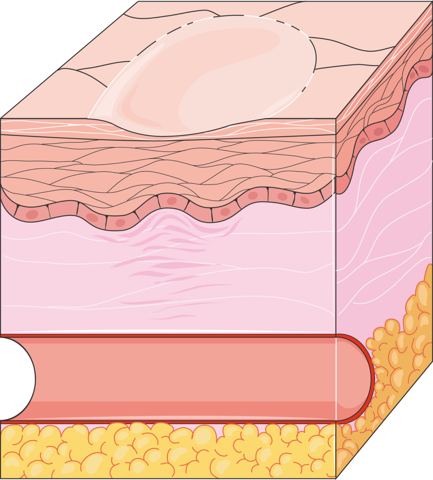 Platelet - Servier Medical Art