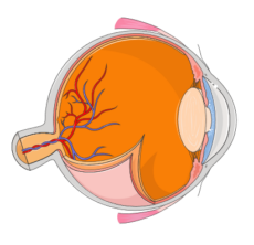 Eye structure with cataract - Servier Medical Art